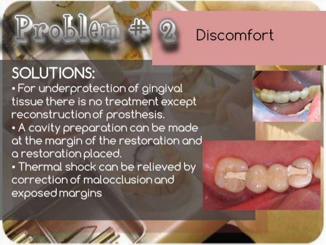 Troubleshooting fpd, rpd and cd