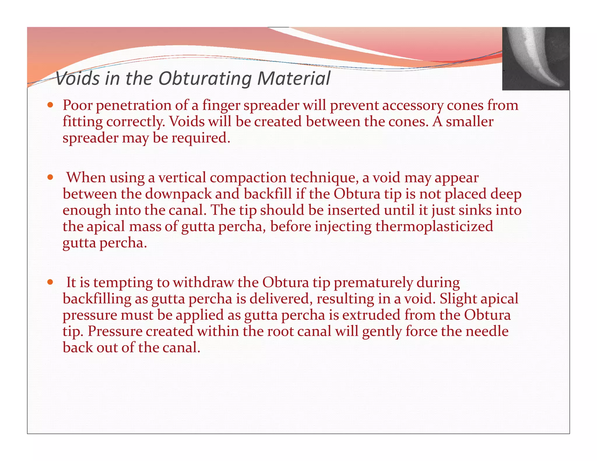 Trouble shooting in endodontics | PDF