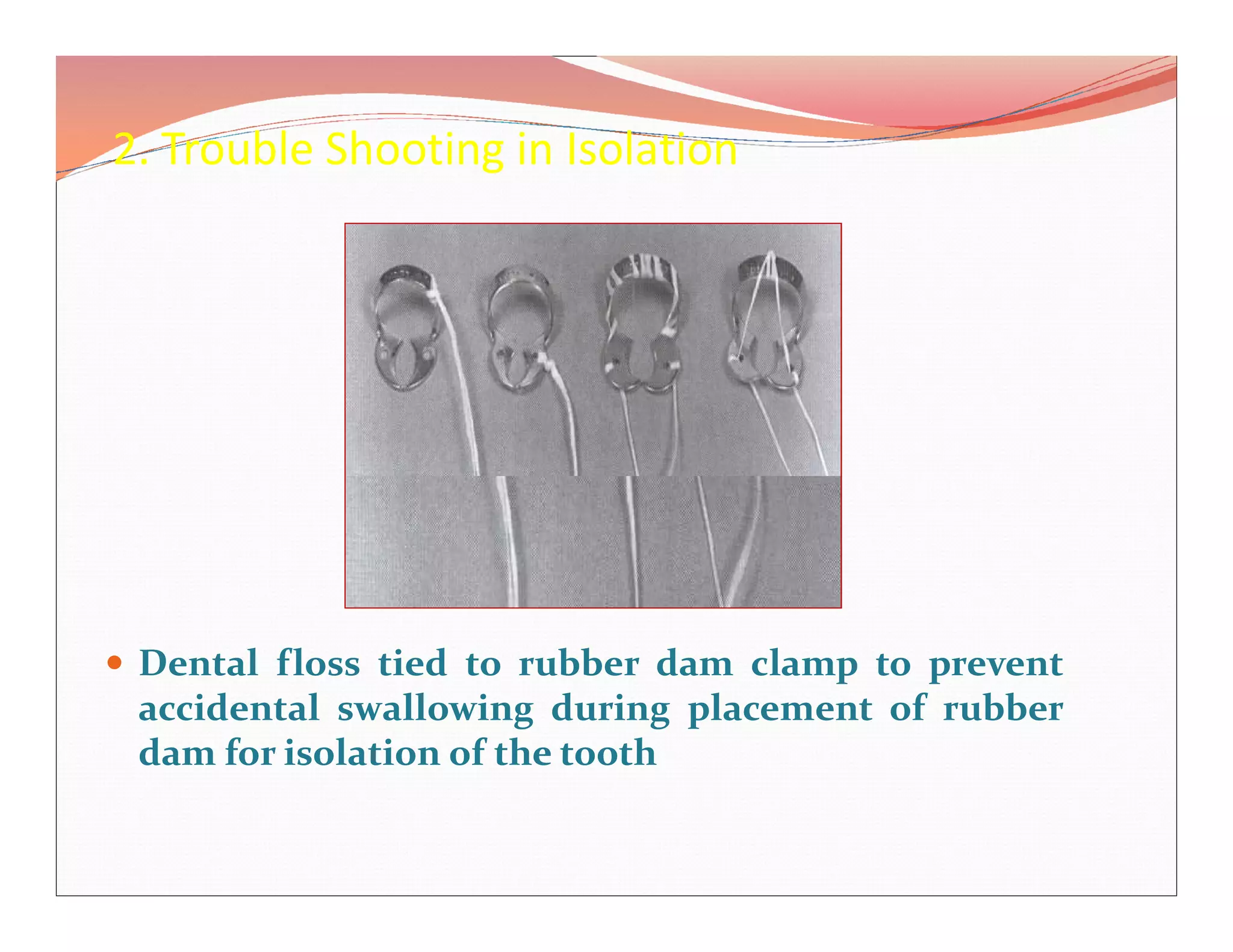 Trouble shooting in endodontics | PDF
