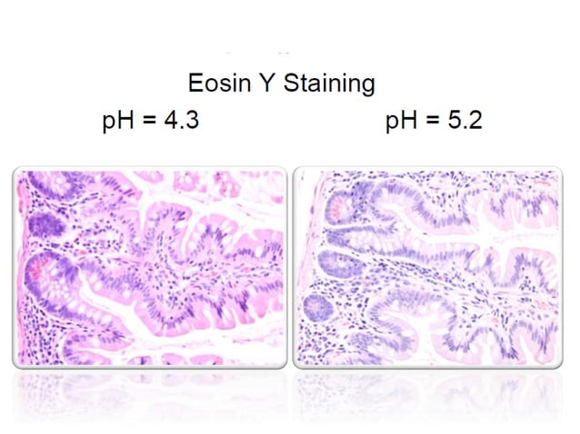 Troubleshooting in H&E Staining | PPTX