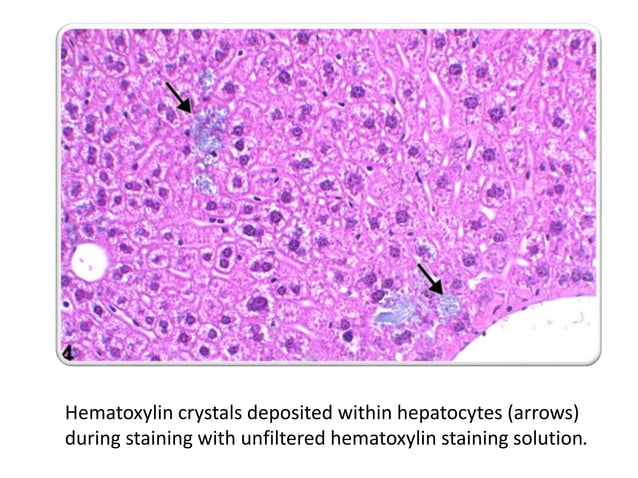 Troubleshooting in H&E Staining | PPTX