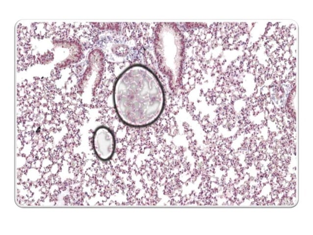 Troubleshooting in H&E Staining | PPTX