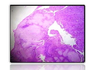 Troubleshooting in H&E Staining | PPTX