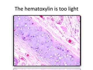 Hematoxylin And Eosin (H&E) Staining, Classification,, 54% OFF