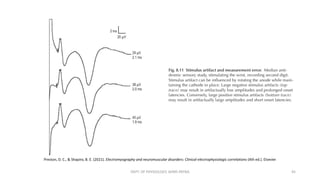 Troubleshooting in Nerve Conduction and EMG Studies : Technical Errors ...