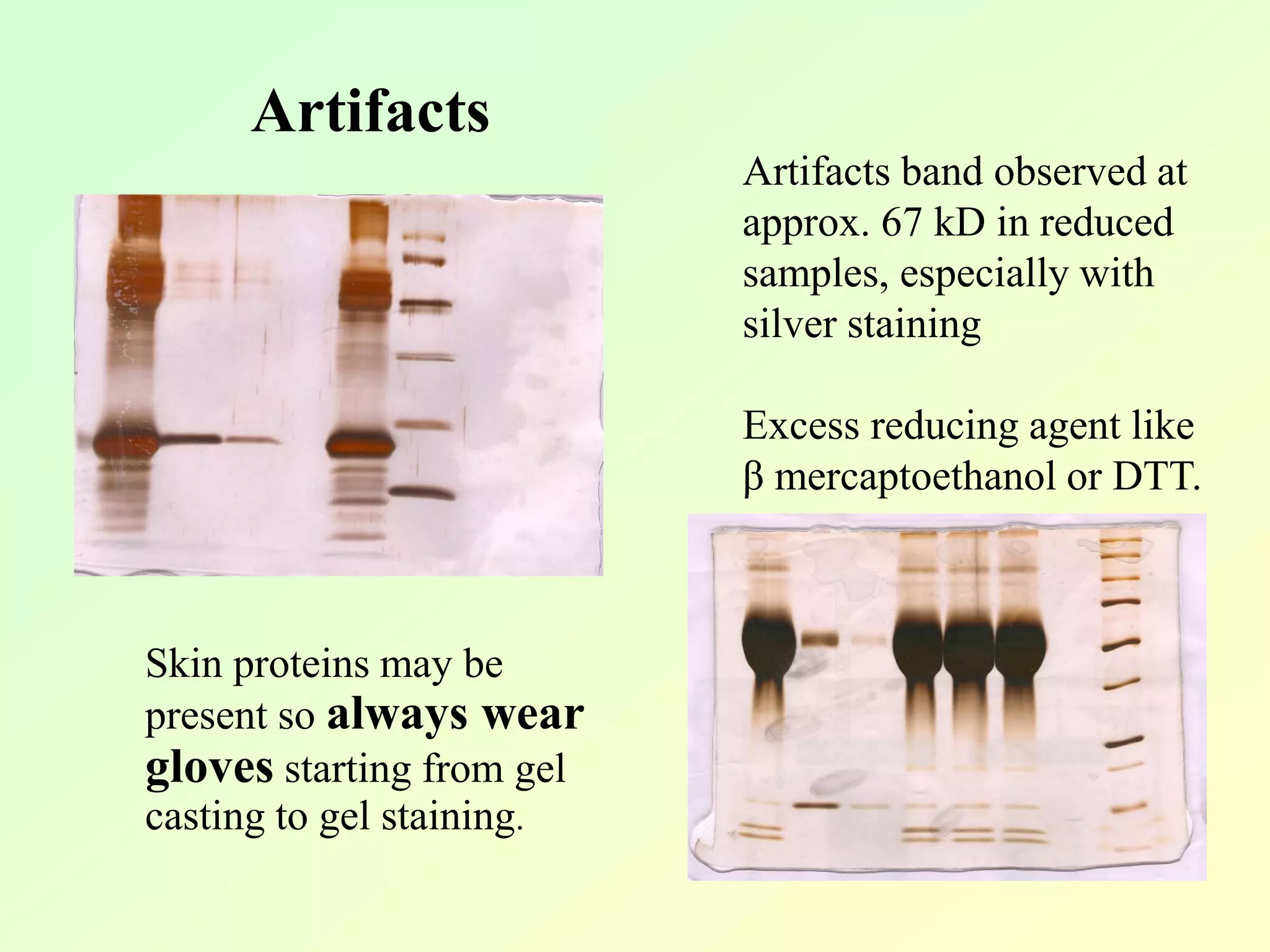Trouble Shooting of SDS PAGE Analysis | PDF