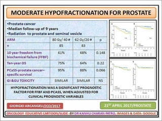 PROSTATE CANCER POST OP RADIOTHERAPY | PPTX