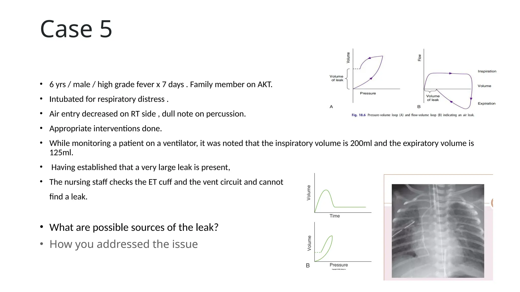 TROUBLESHOOTING USING VENTILATOR GRAPHICS.pptx