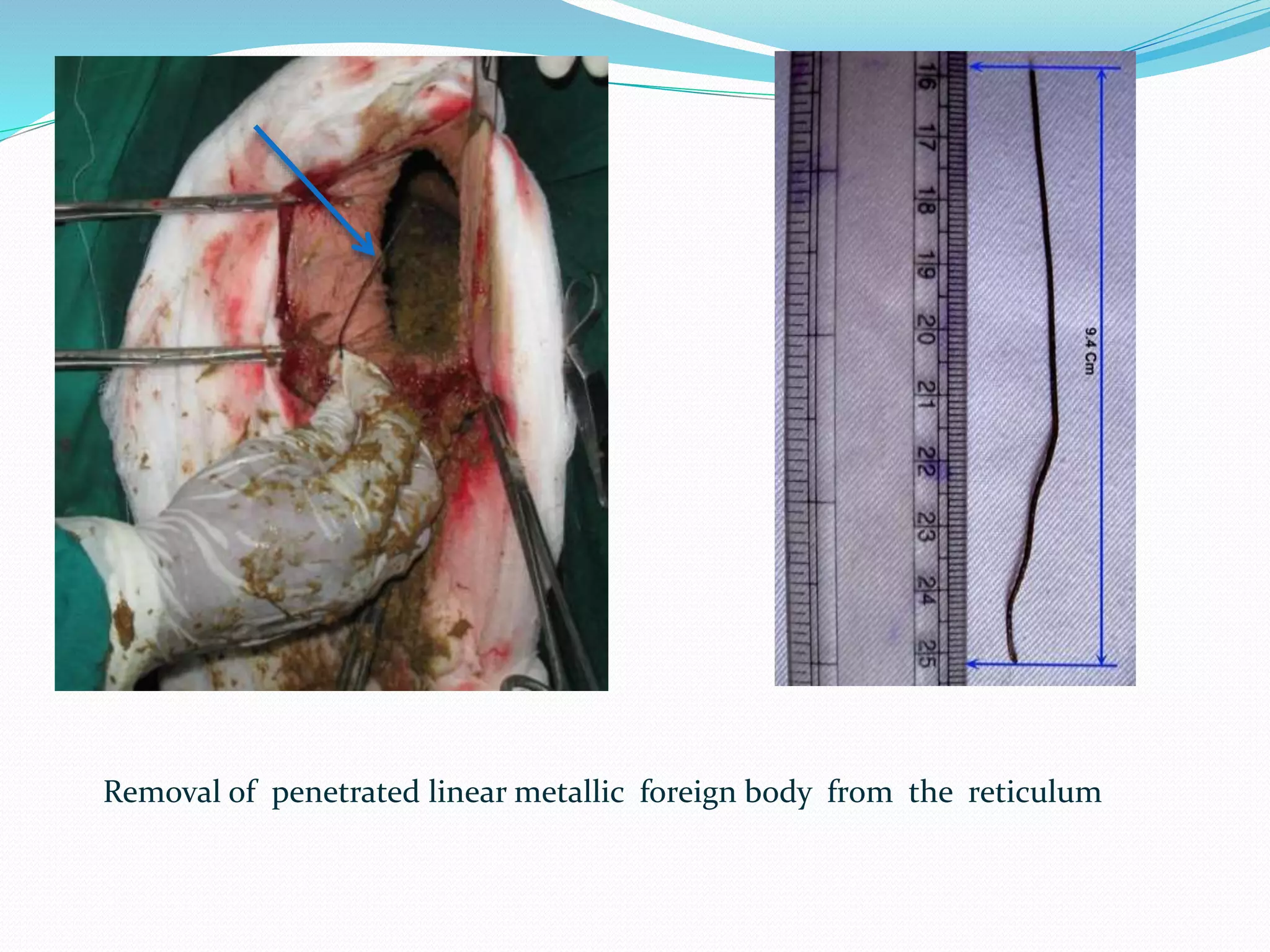 Traumatic reticuloperitonitis , traumatic pericarditis | PPTX