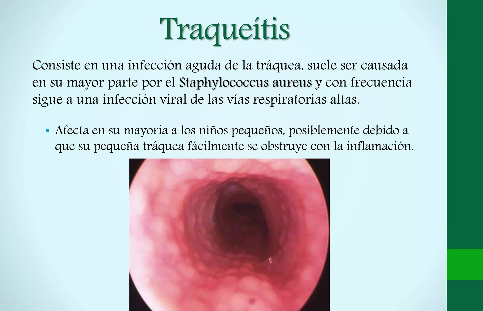 Tráquea pmh | PPTX | Lung and Respiratory Health | Diseases and Conditions