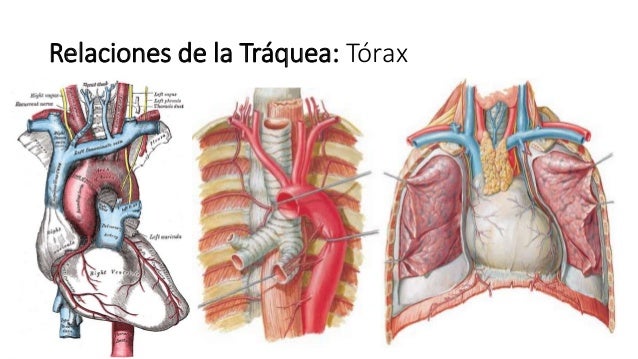 Tráquea y bronquios