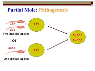 Gestational trophoblastic disease-Hamisi Mkindi | PPT | Pregnancy ...