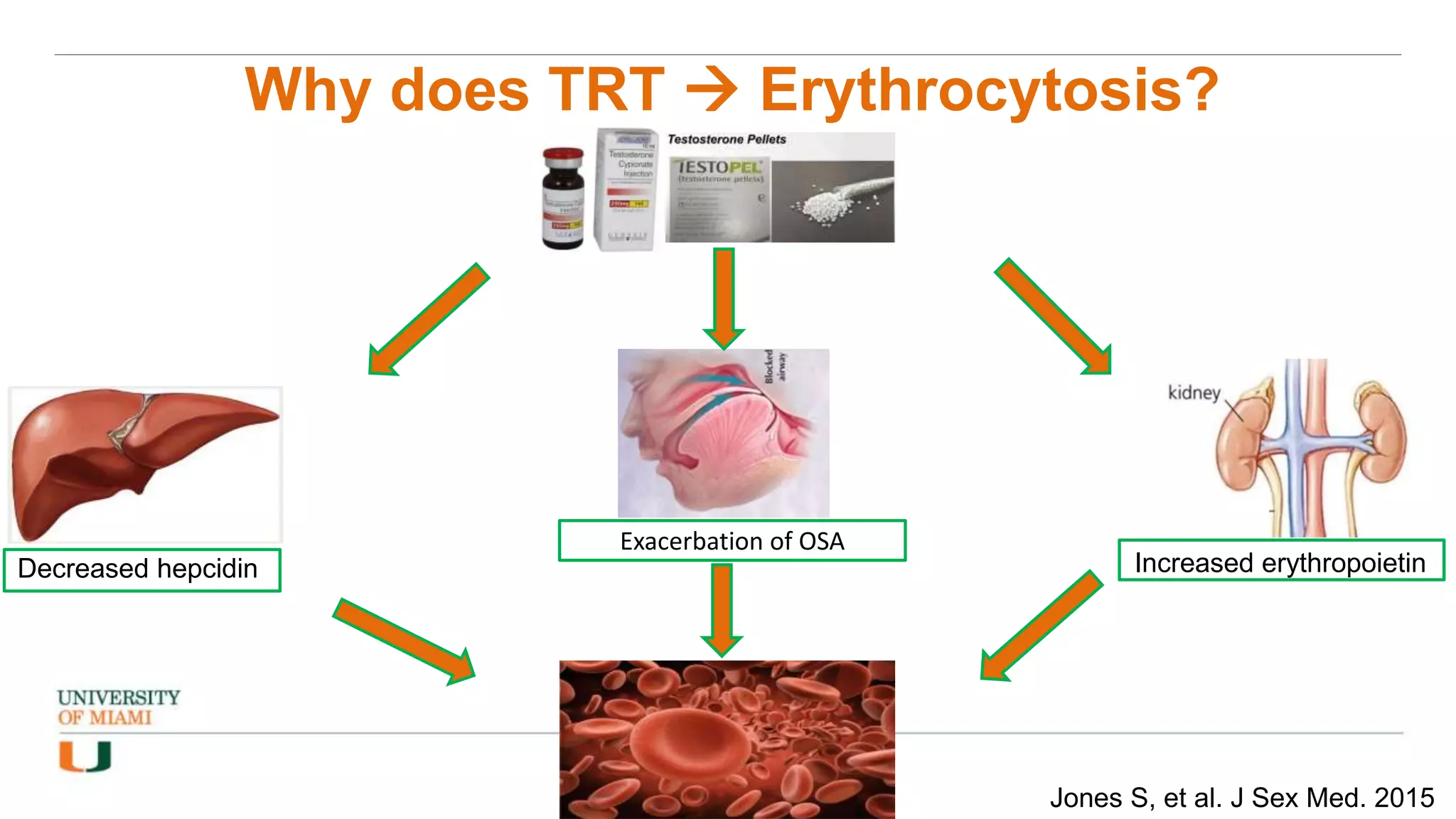 Testosterone therapy and Polycythemia | PPT