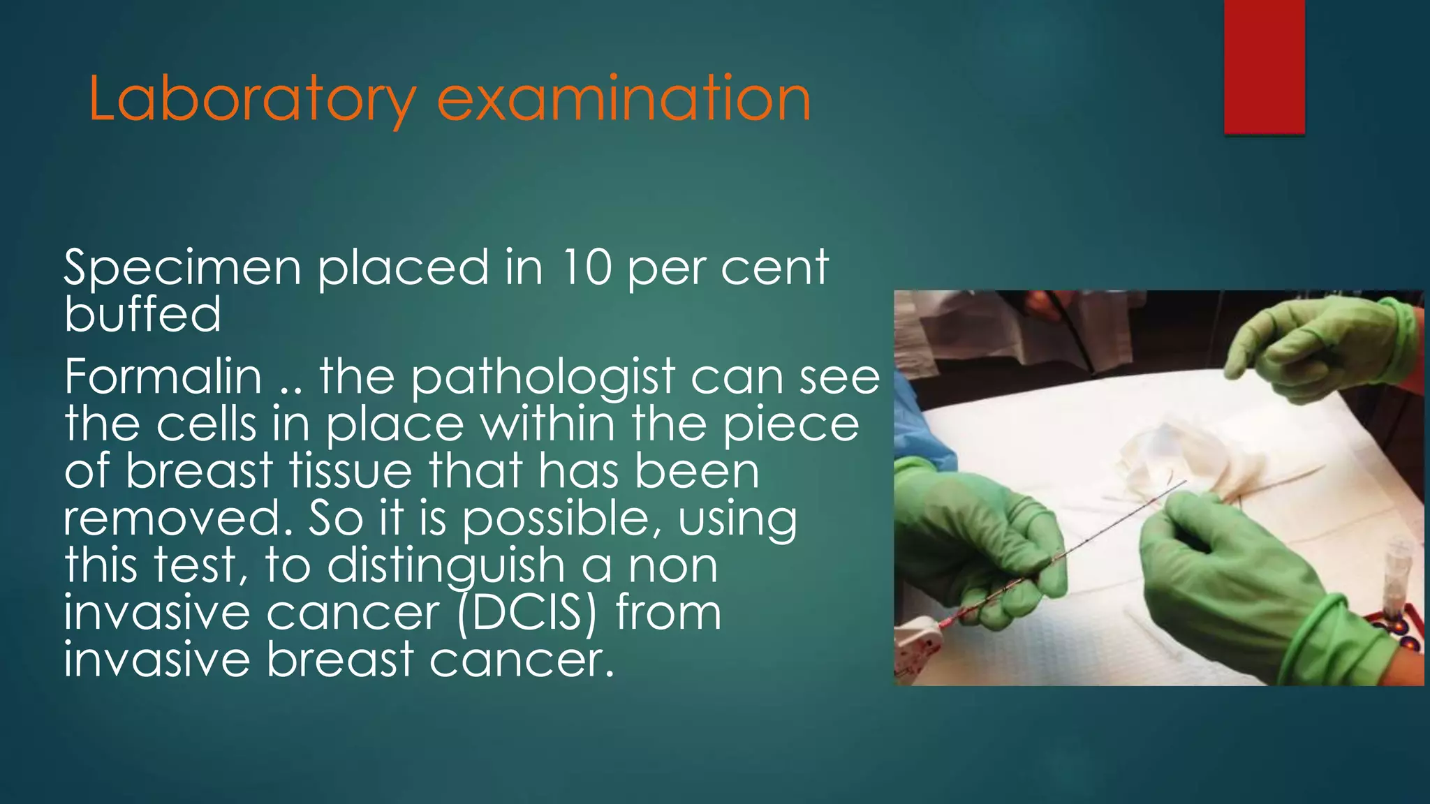 core biopsy of breast | PPTX