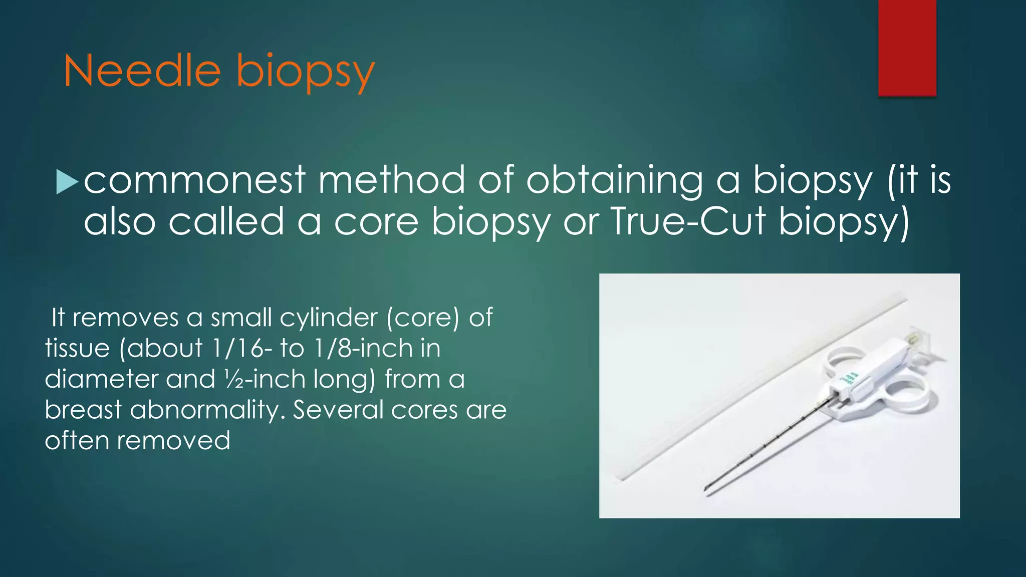 core biopsy of breast | PPTX