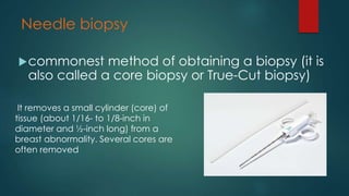 core biopsy of breast | PPTX
