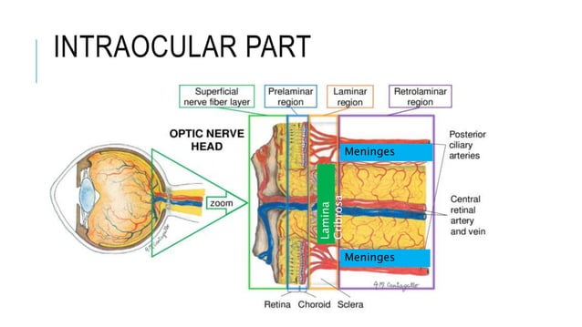 Optic Disc Swelling | PPTX | Eye and Vision Conditions | Diseases and ...