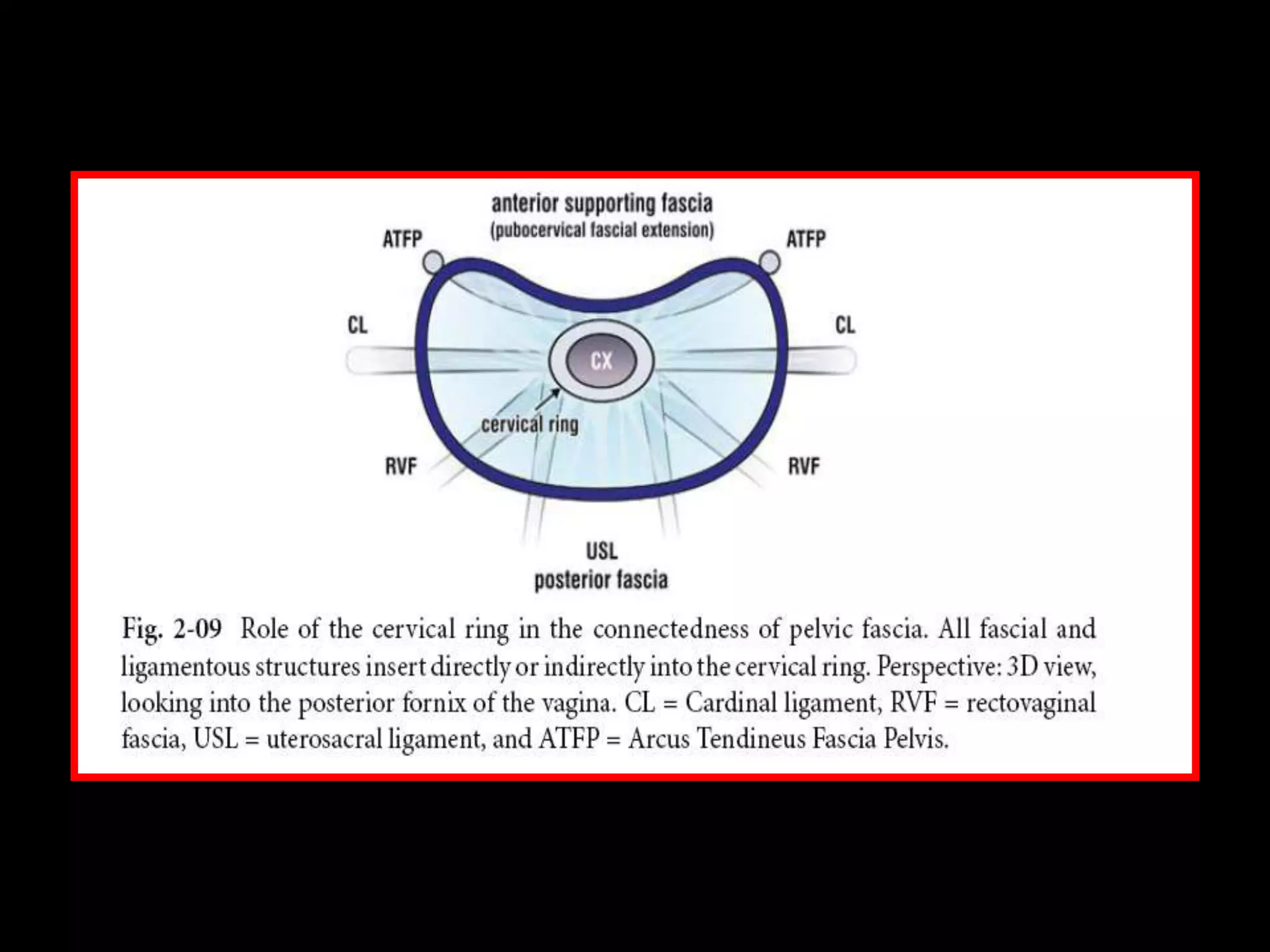 Importancia De La Preservación Del Anillo Pericervical En | PPTX ...