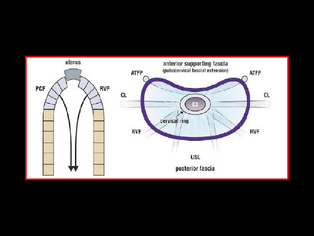Importancia De La Preservación Del Anillo Pericervical En