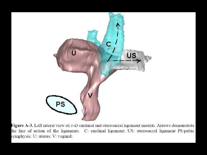 Importancia De La Preservación Del Anillo Pericervical En
