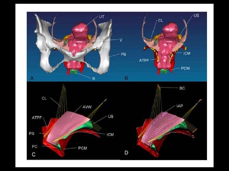 Importancia De La Preservación Del Anillo Pericervical En