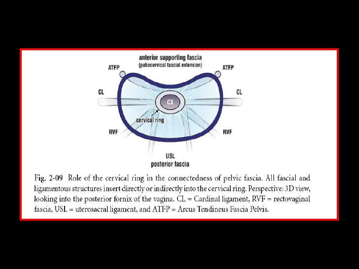 Importancia De La Preservación Del Anillo Pericervical En