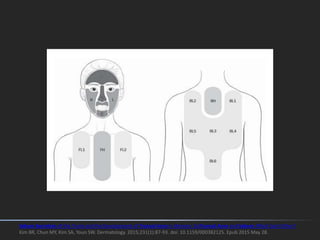 Truncal acne: evidence for treatment | PPTX