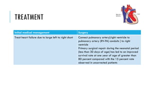 Truncus arteriosus | PPTX