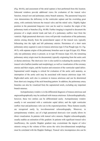 Truncus arteriosus | PDF