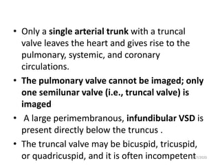 Truncus arteriosus | PPT