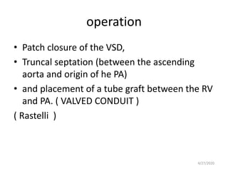 Truncus arteriosus | PPT