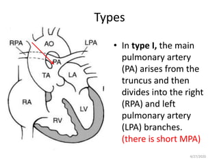 Truncus arteriosus | PPT