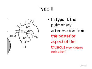 Truncus arteriosus | PPT