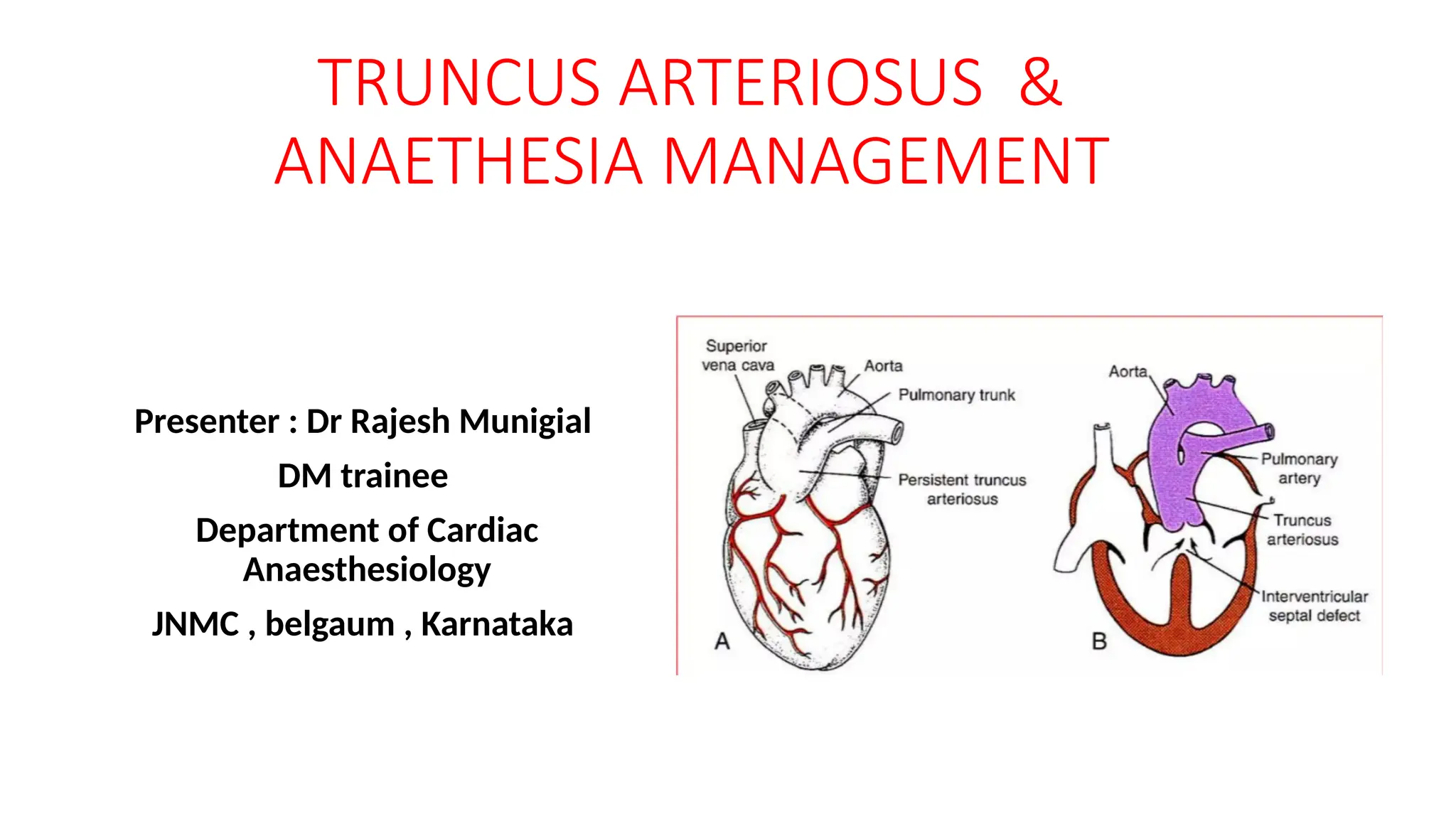 truncus arteriosus anaesthesia management | PPTX