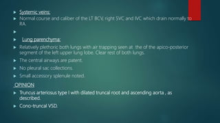 Truncus arteriosus - Hemitruncus - Pseudotruncus CT role | PPT