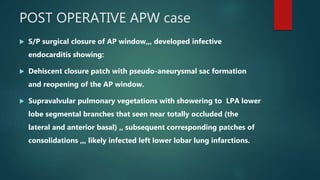 Truncus arteriosus - Hemitruncus - Pseudotruncus CT role | PPT