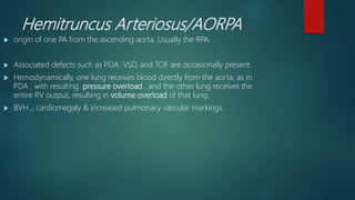 Truncus arteriosus - Hemitruncus - Pseudotruncus CT role | PPT