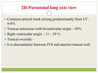 Truncus Arteriosus | PPTX