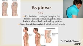 Trunk and Cervical orthoses with evaluation | PDF