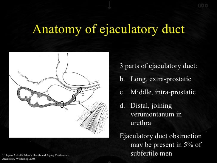 Ejaculatory Duct Pal