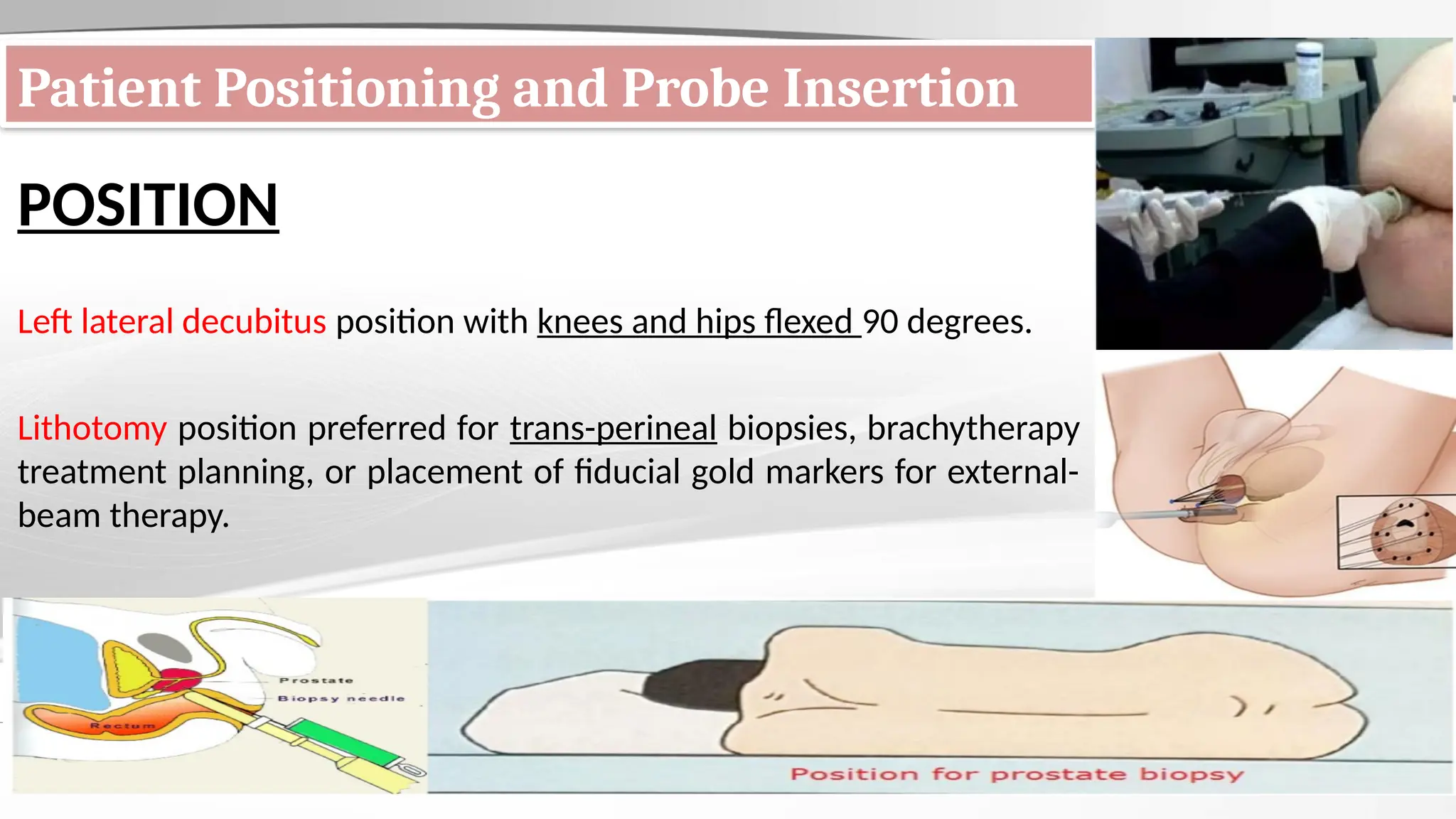 Trans rectal ultrasound and biopsy .pptx