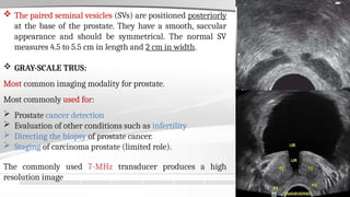 Trans rectal ultrasound and biopsy .pptx