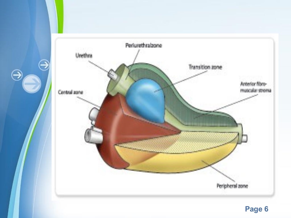 Trus biopsy prostate