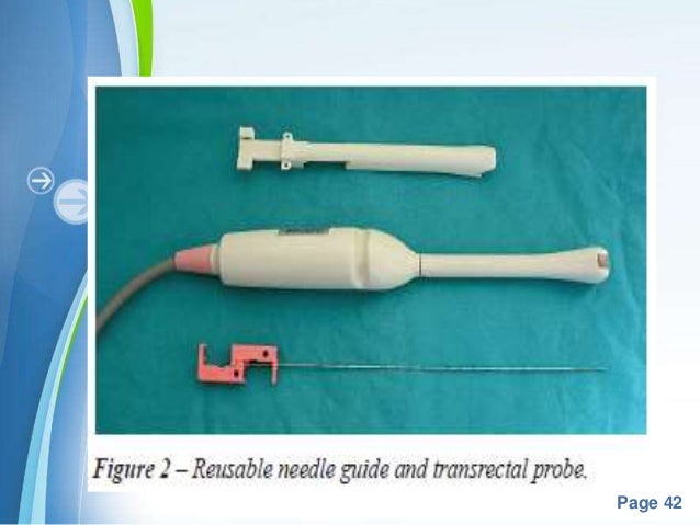 Trus Biopsy Prostate