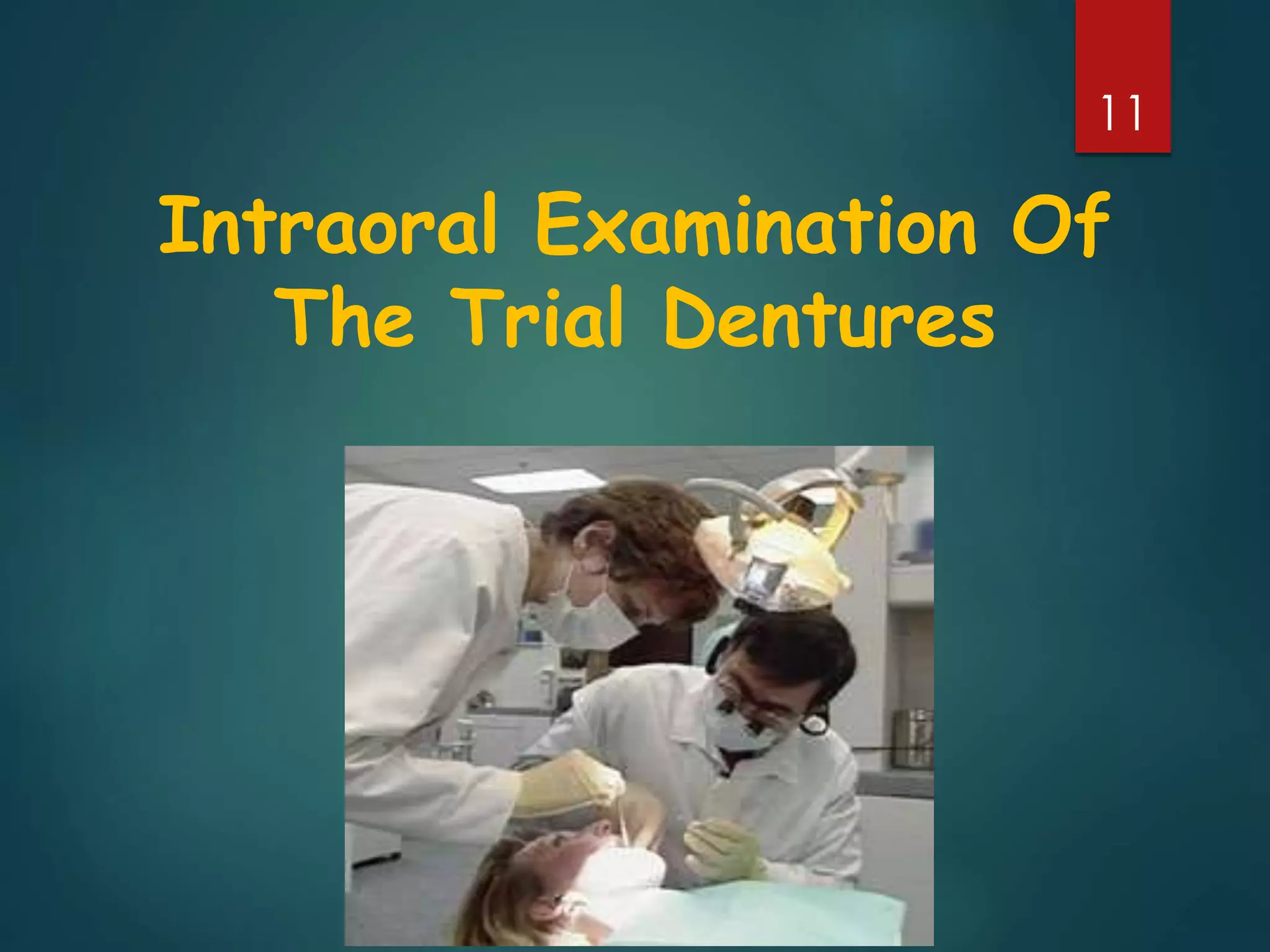 Try in of complete dentures | PPTX