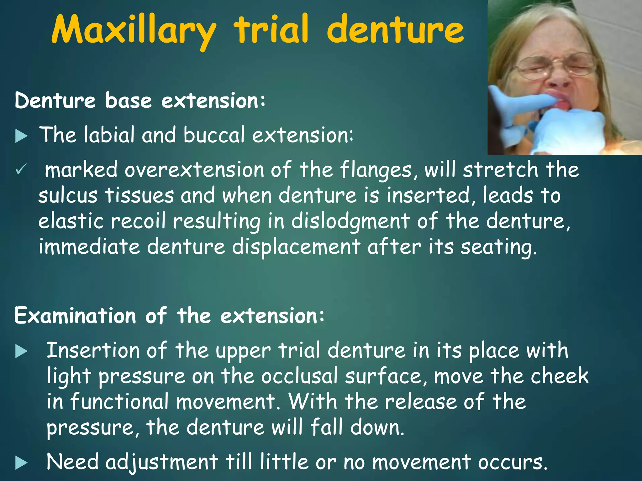 Try in of complete dentures | PPTX