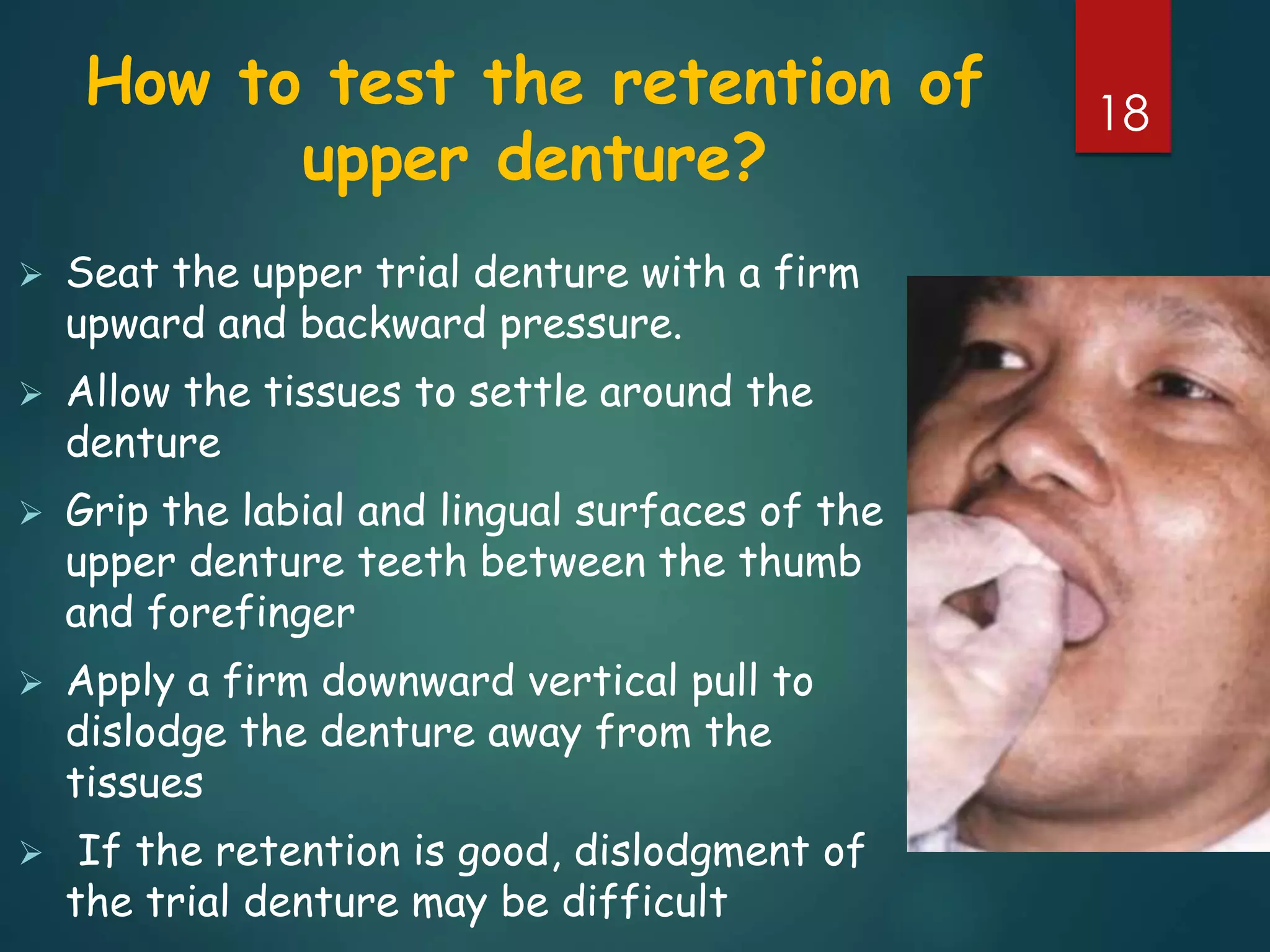 Try in of complete dentures | PPTX