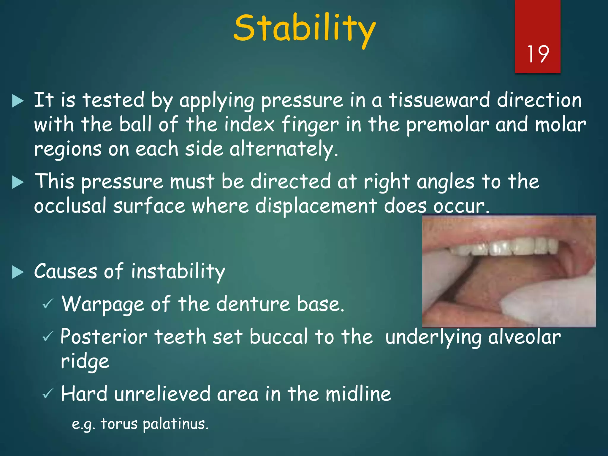 Try in of complete dentures | PPTX