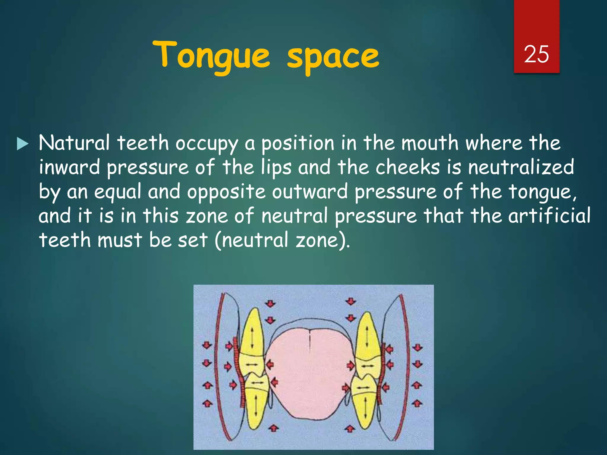 Try in of complete dentures | PPTX