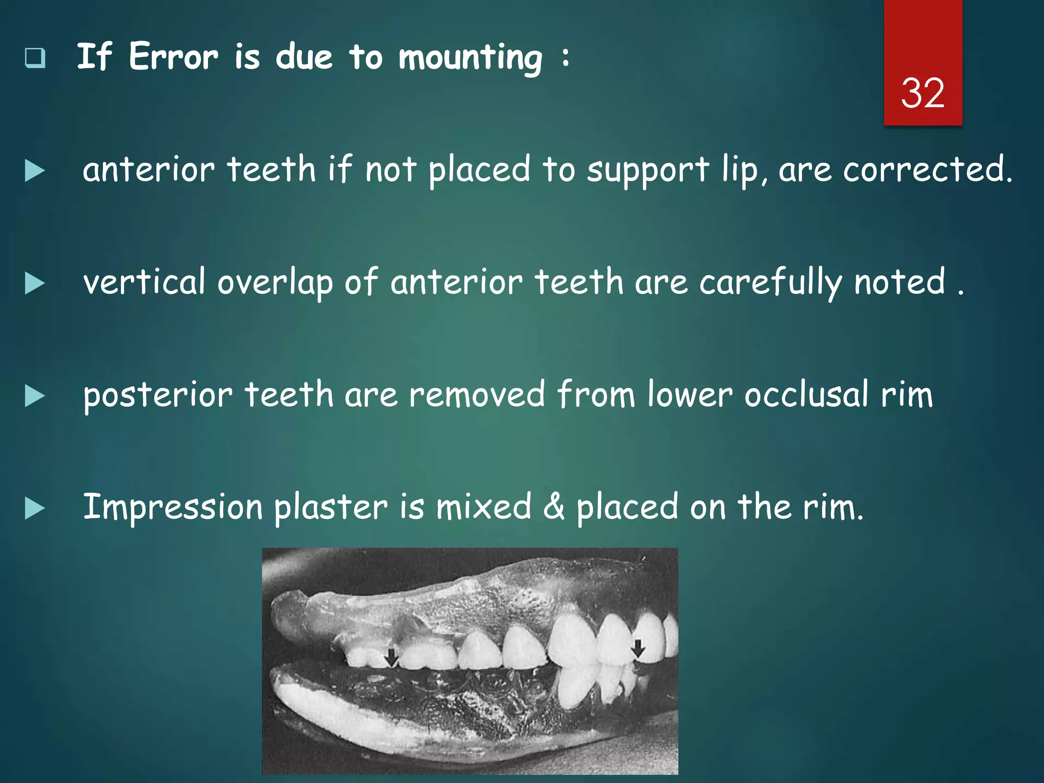 Try in of complete dentures | PPTX